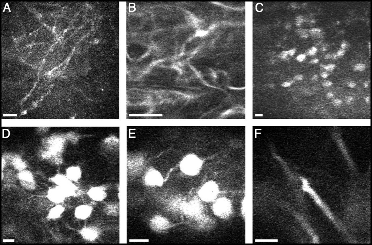 BCI Research - Solutions
